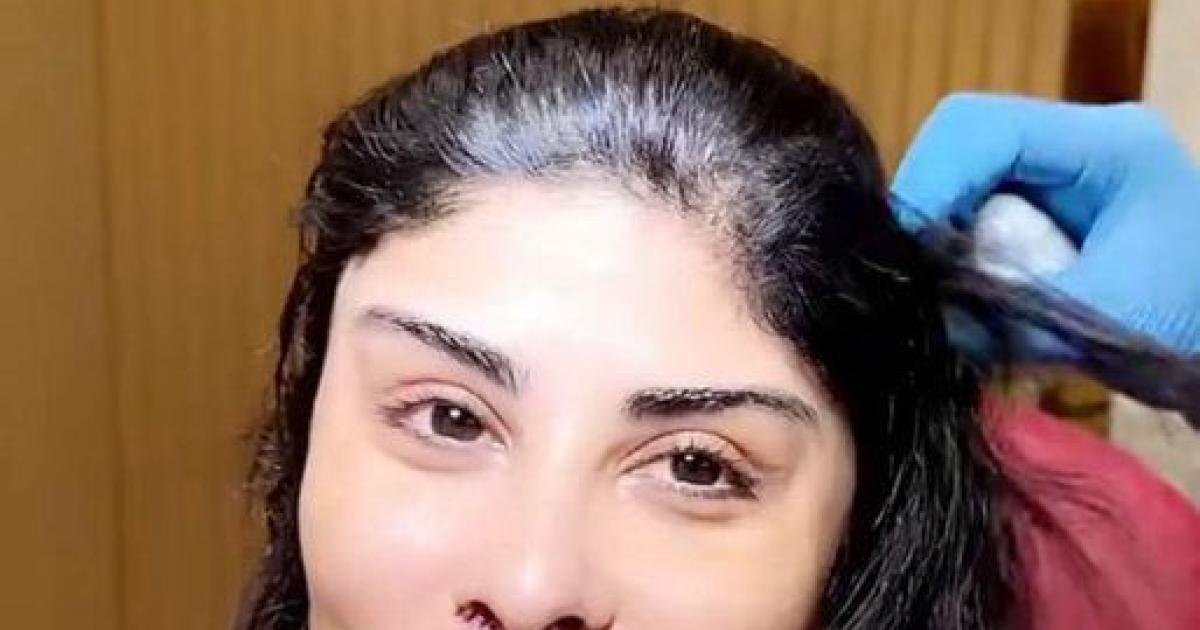 زارا البلوشي ترد على الصور المتداولة لها بعد عملية التجميل Et بالعربي